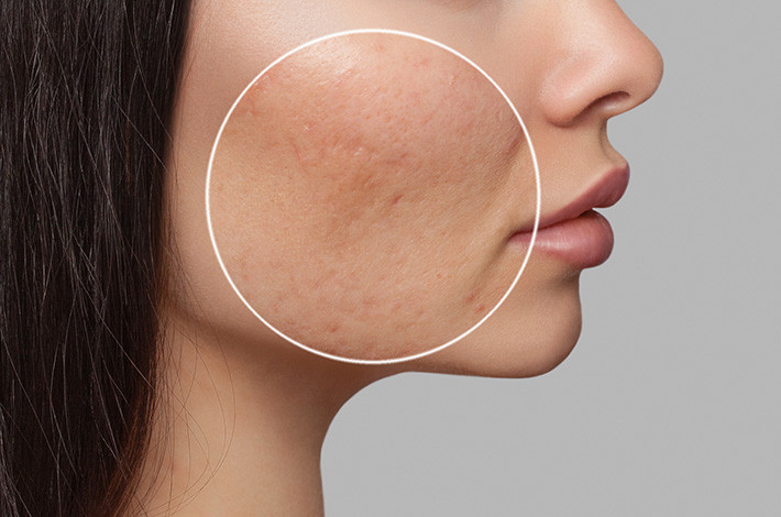 Камелокс гель - инструкция по применению: показания и побочные действия ...